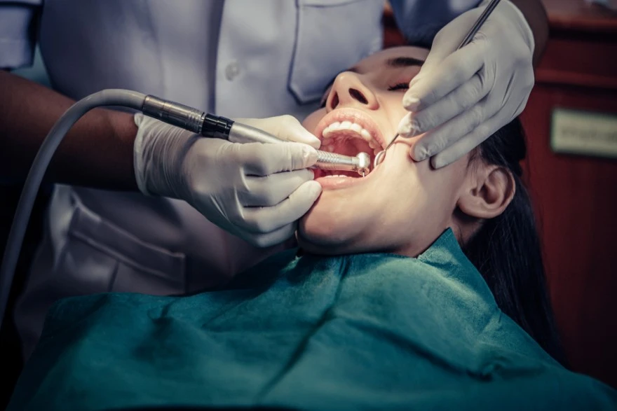 Cavities (Tooth Decay): Symptoms, Causes, Stages & Treatment
